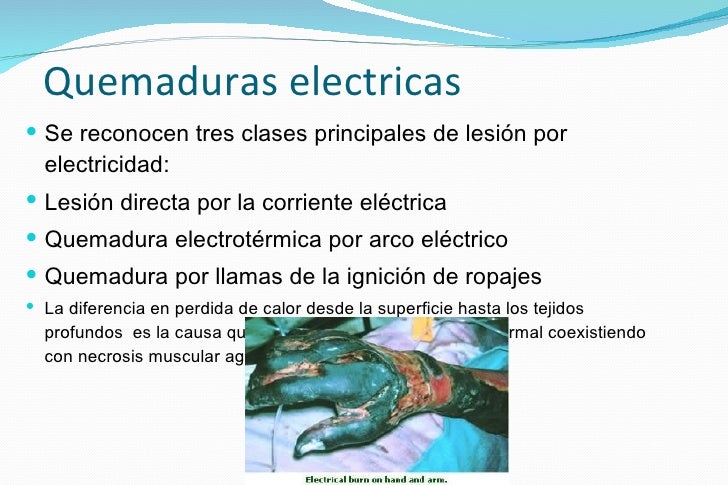 Quemaduras Termicas Electricas Frio Quimicas