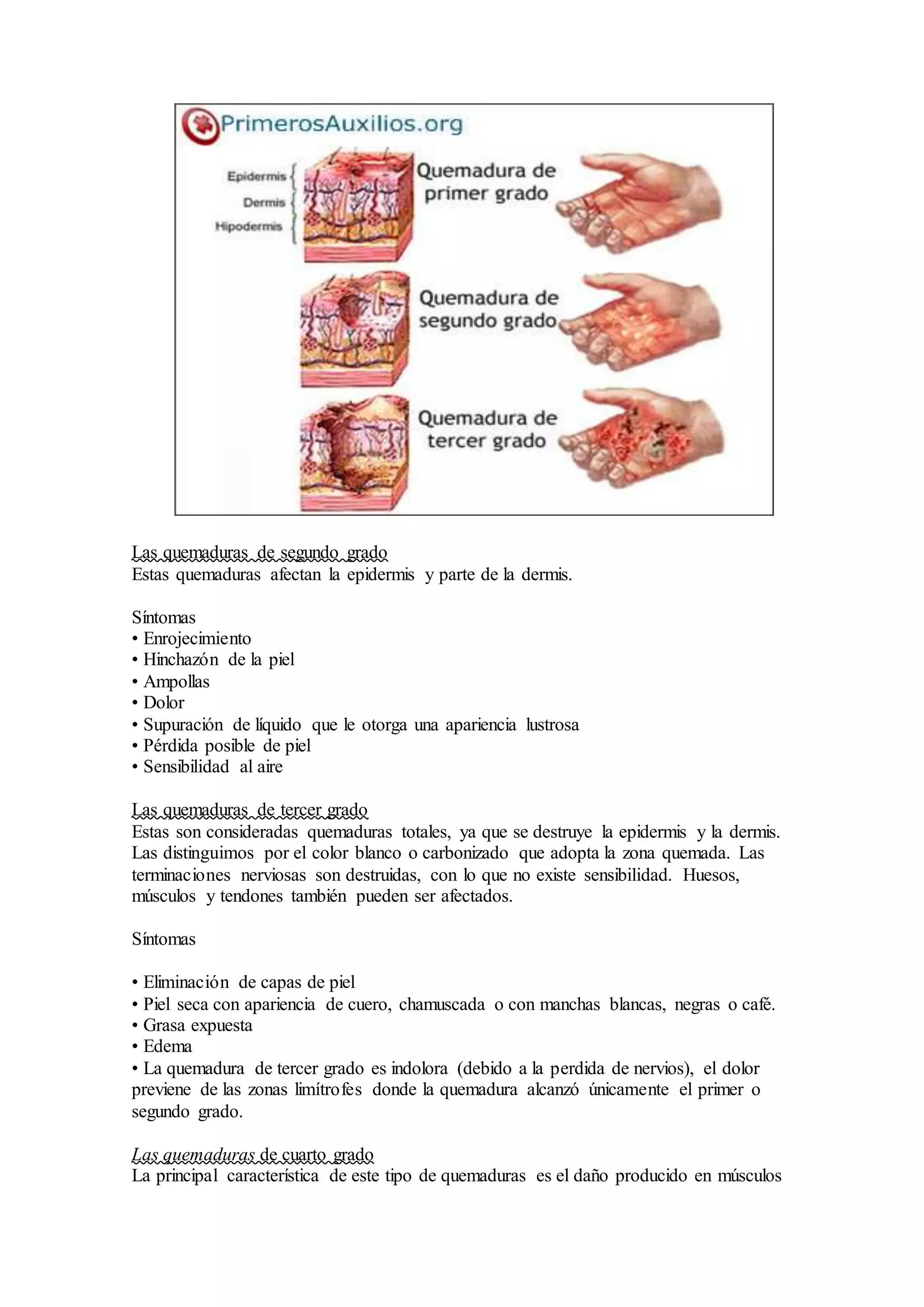Quemaduras tipos | PDF