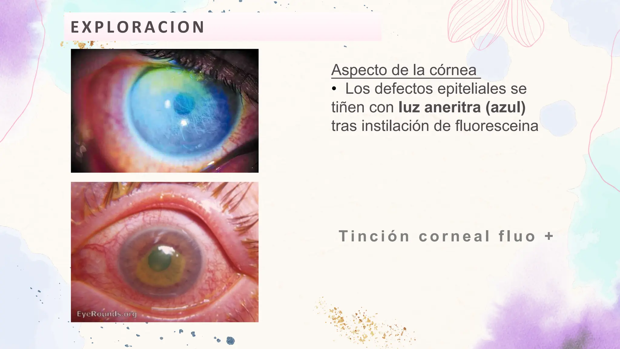 Queratitis_infecciosa en el ojo humano presentacion | PDF