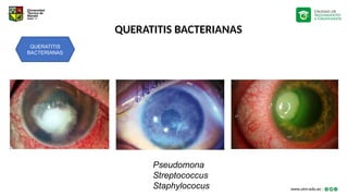 QUERATITIS MICÓTICAS PATRICIA DURAN OSPINA.pptx