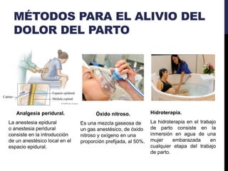 Qué es el Parto.pptx