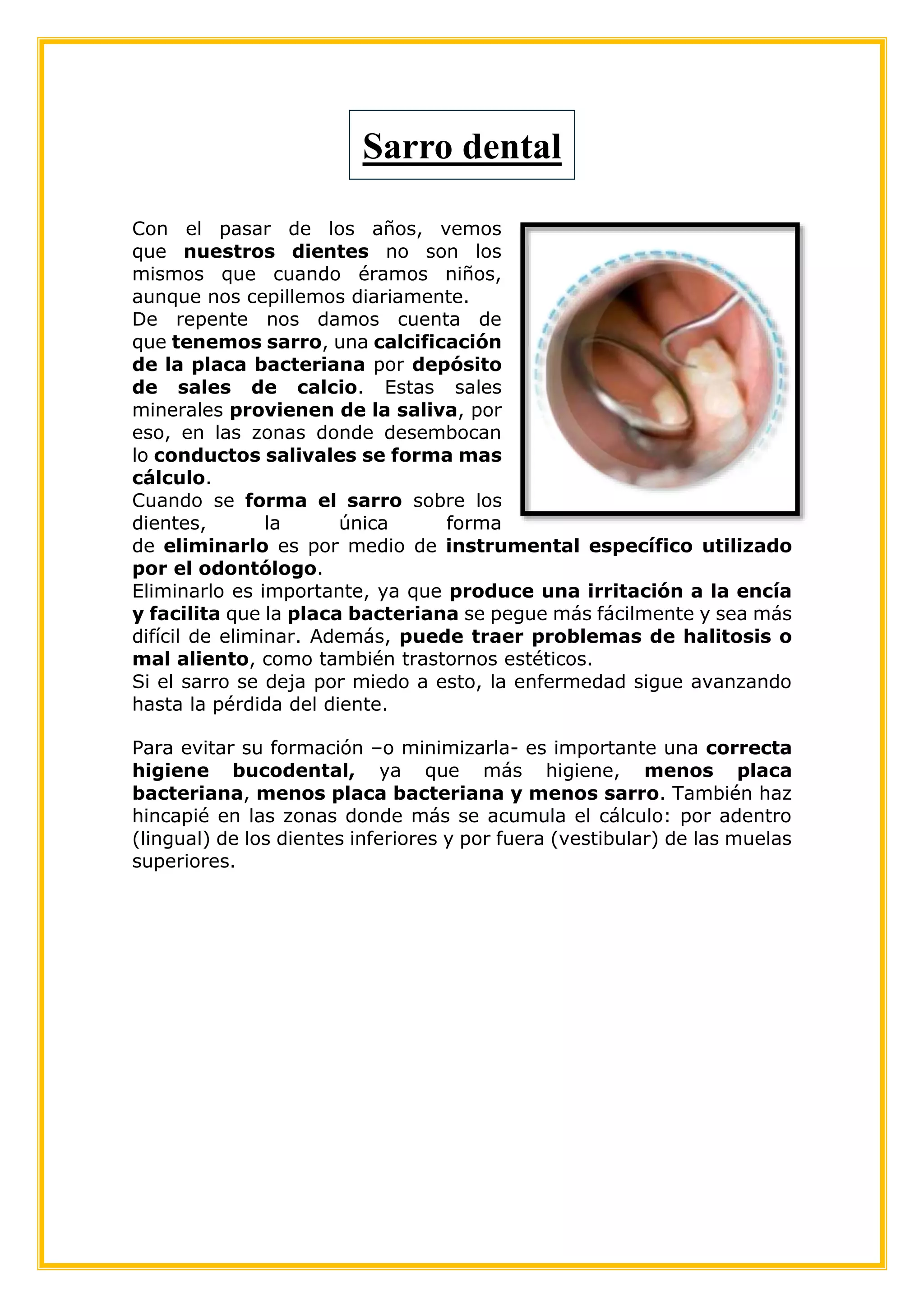 Qué es y cómo se forma el sarro dental | DOCX | Dental Health ...