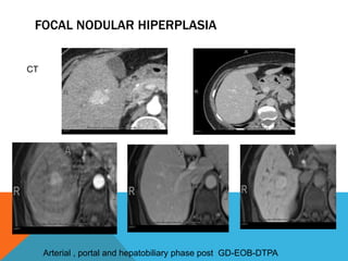Quick review of hepatobiliary and pancreatic lesion | PPTX