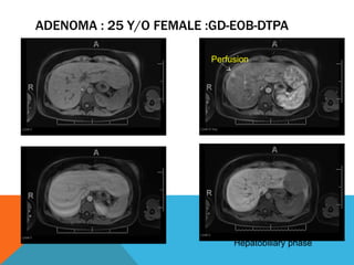 Quick review of hepatobiliary and pancreatic lesion | PPTX
