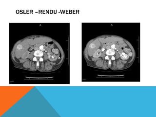 Quick review of hepatobiliary and pancreatic lesion | PPTX