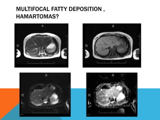 Quick review of hepatobiliary and pancreatic lesion | PPTX
