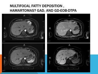 Quick review of hepatobiliary and pancreatic lesion | PPTX