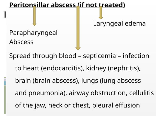 A Tonsillar Abscess Is A Collection Of Pus That Forms In One Of The