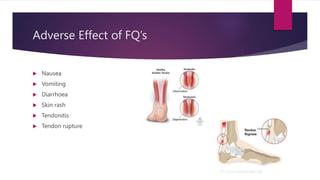 Quinolones & Fluoroquinolones.pptx