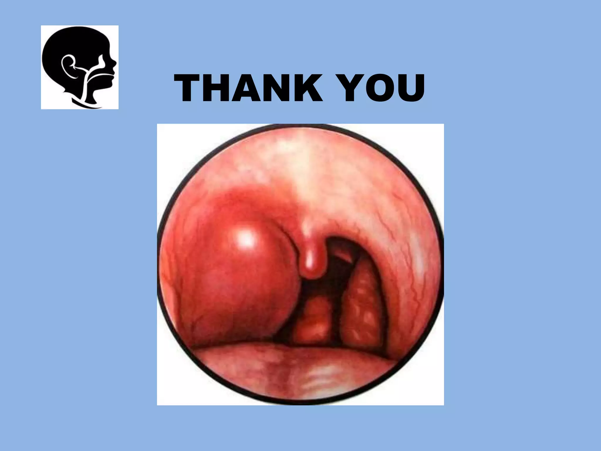 Quinsy or Peritonsillar Abscess | PPTX