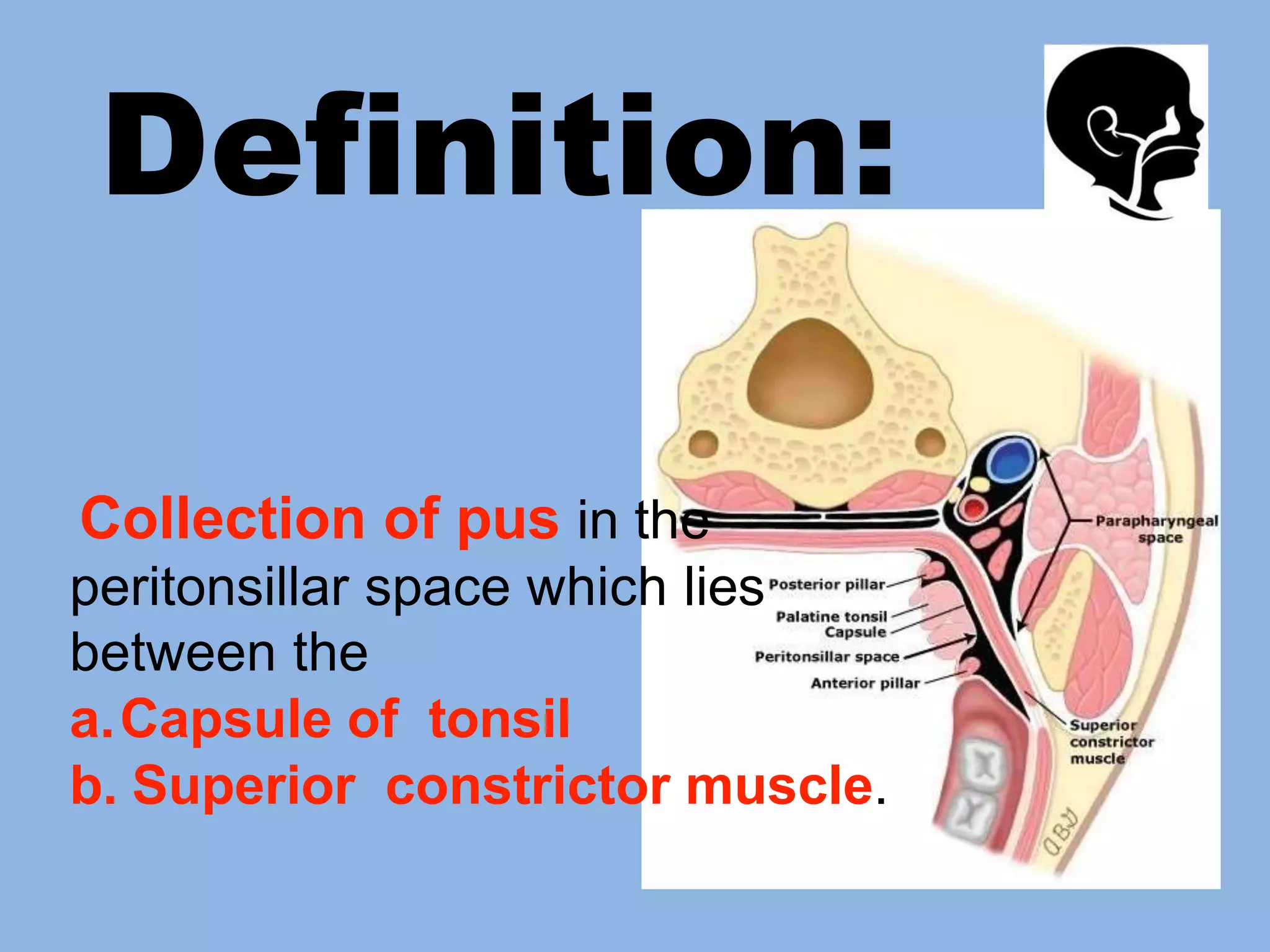 Quinsy or Peritonsillar Abscess | PPTX