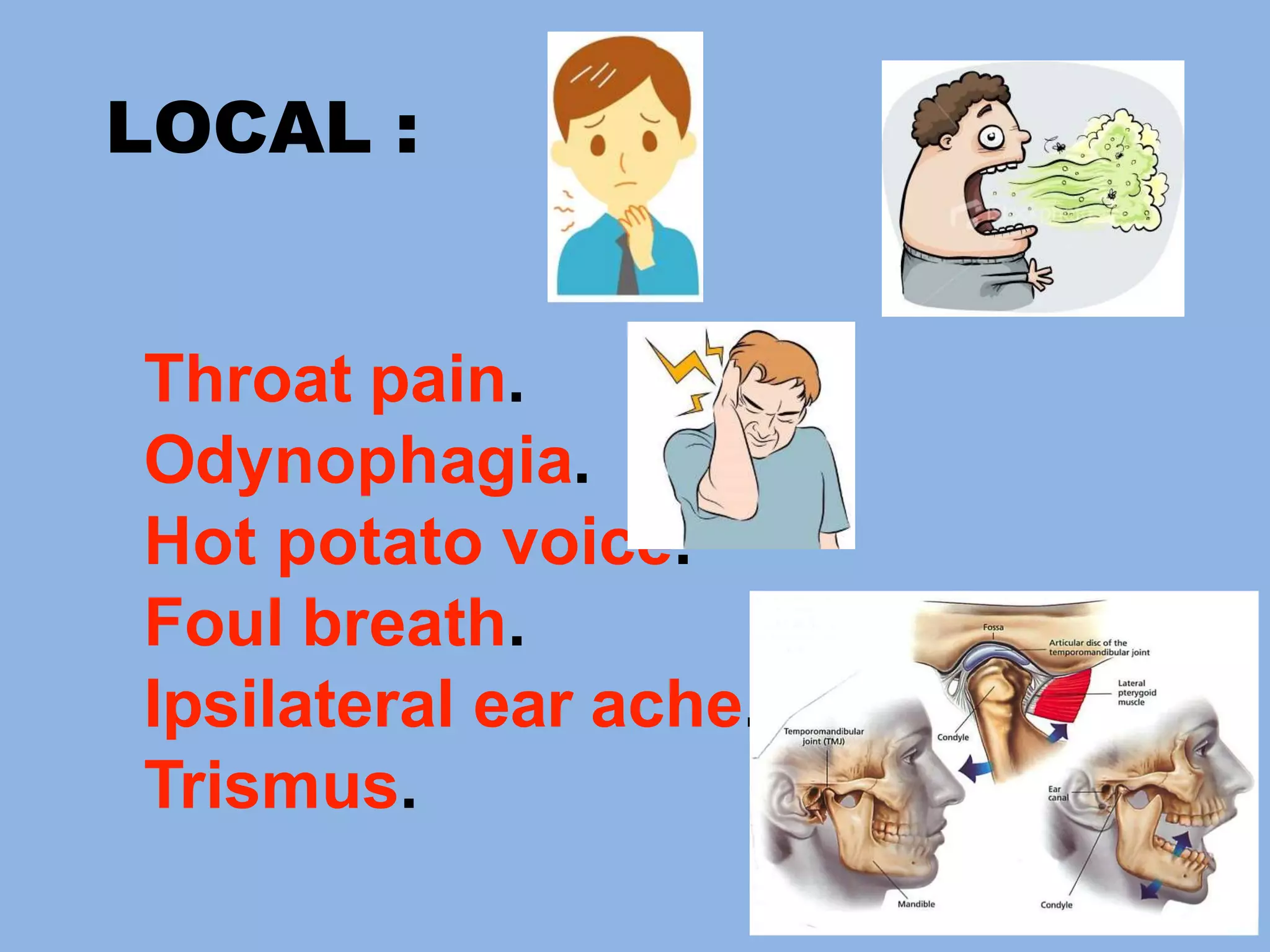 Quinsy or Peritonsillar Abscess | PPTX