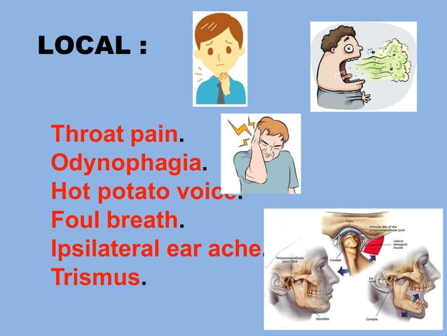 Quinsy or Peritonsillar Abscess | PPTX