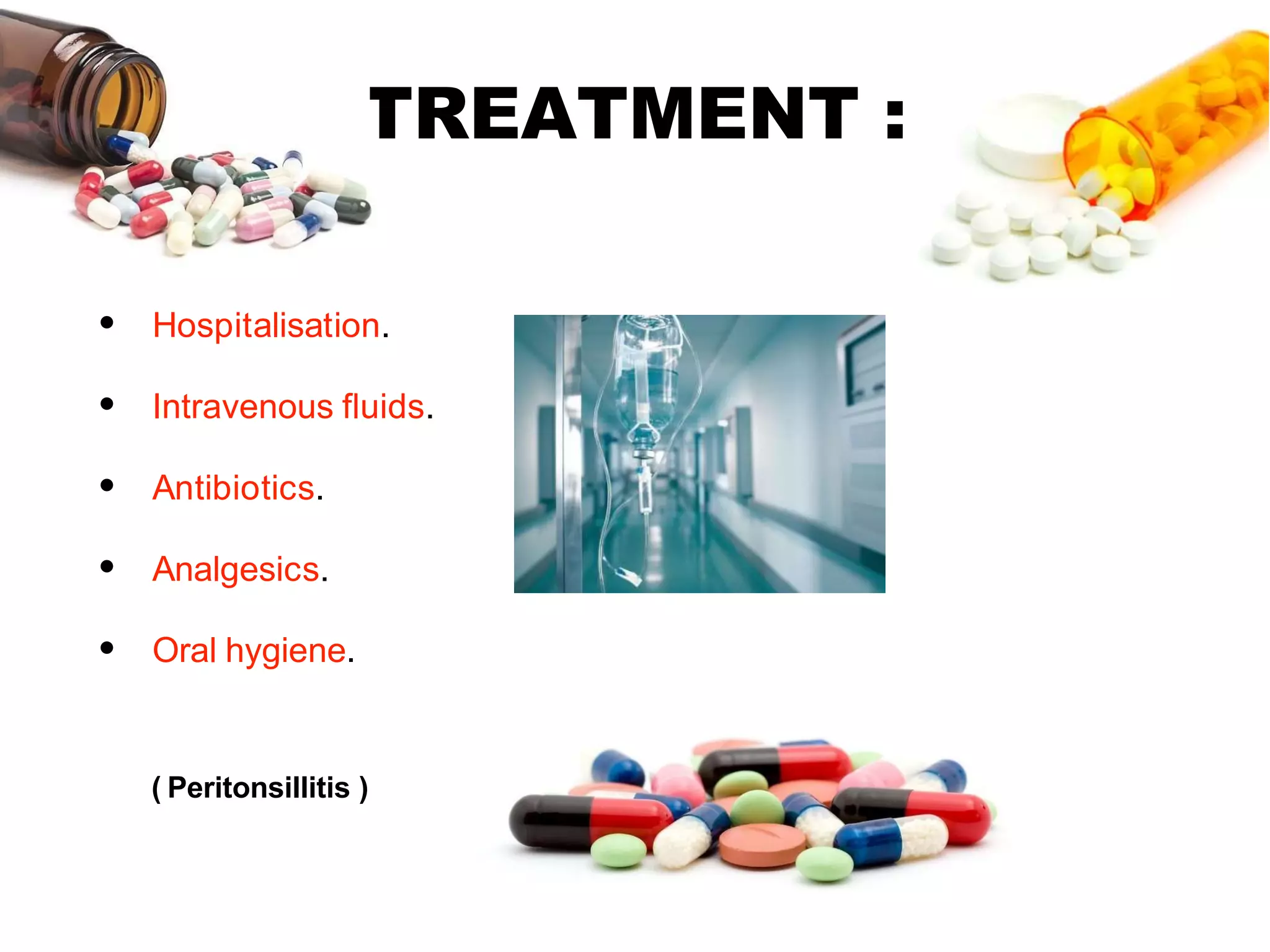 Quinsy or Peritonsillar Abscess.pptx