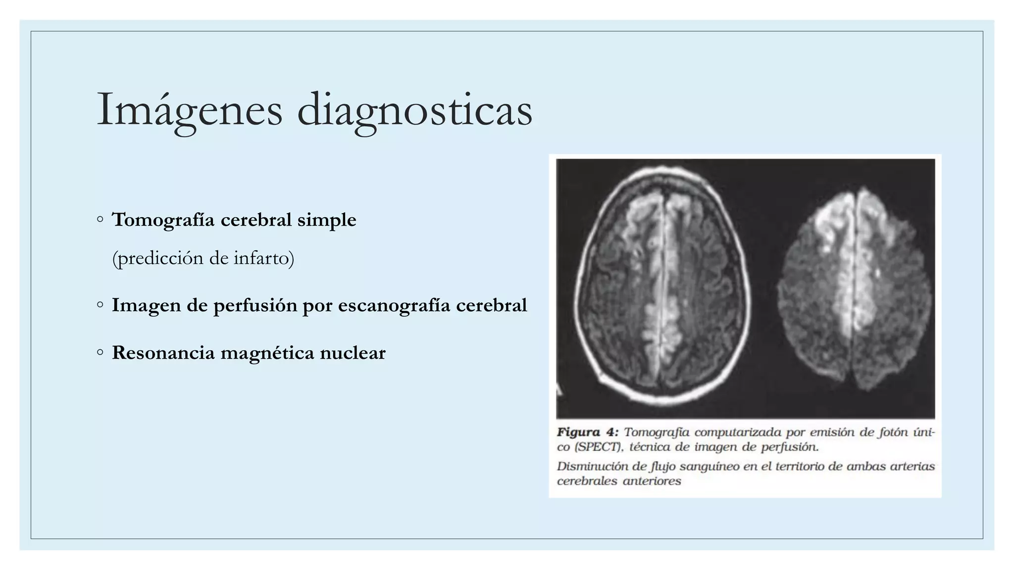 Vasoespasmo cerebral en HSA - Quispe Llanos Luz | PDF | Brain and ...