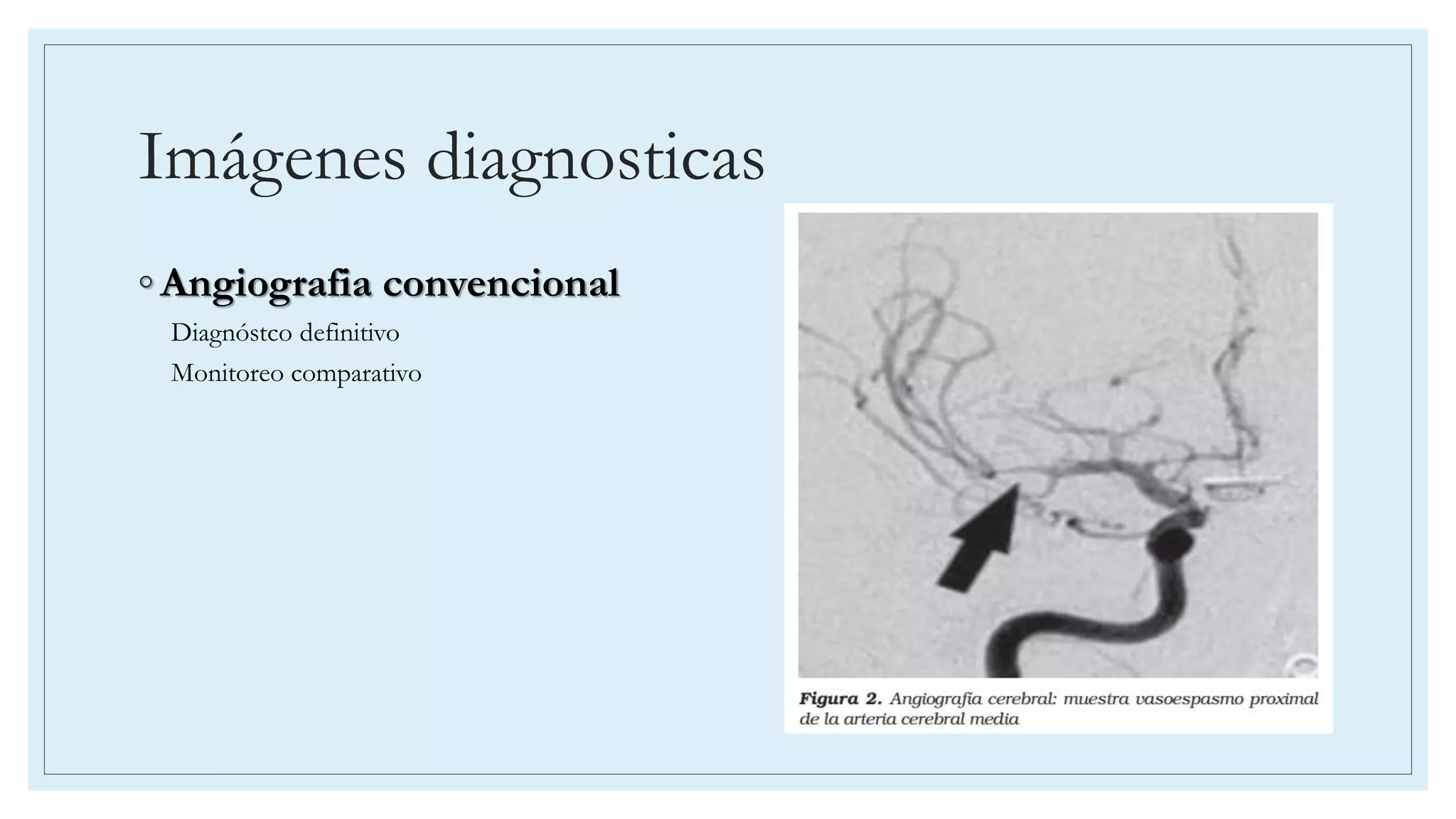 Vasoespasmo cerebral en HSA - Quispe Llanos Luz | PDF | Brain and ...