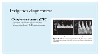 Vasoespasmo cerebral en HSA - Quispe Llanos Luz | PDF