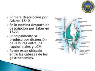 Quiste de baker | PPTX