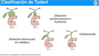 choledochal cyst, anatomy, classification and pathophysiology | PPTX