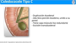 choledochal cyst, anatomy, classification and pathophysiology | PPTX