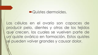 Quiste de ovario | PPTX