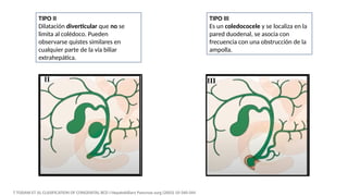 Quistes de coledoco Diagnóstico y tratamiento.pptx