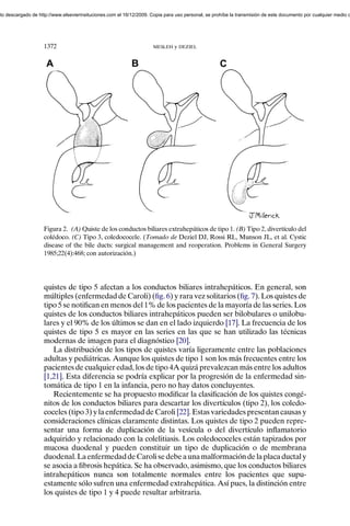 Quistes de los conductos biliares | PDF