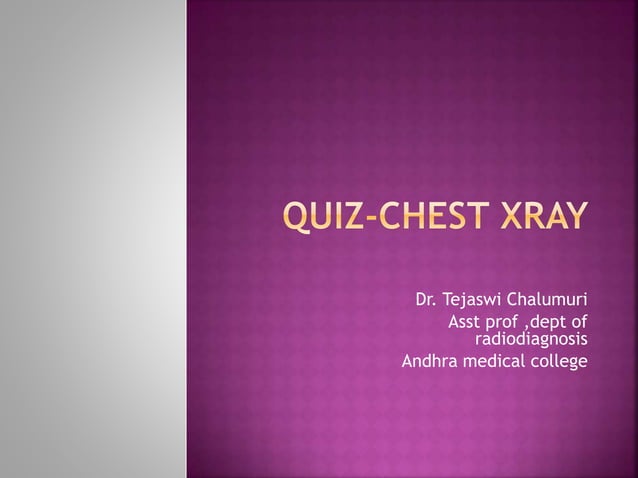 Quiz chest xray | PPTX
