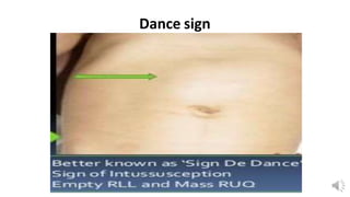 quiz 1 voiceover ppt.pptx