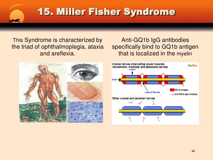 Quiz 25 On Ophthalmoplegia