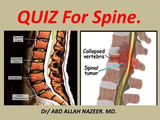 Vertebral Column Anatomy Quiz