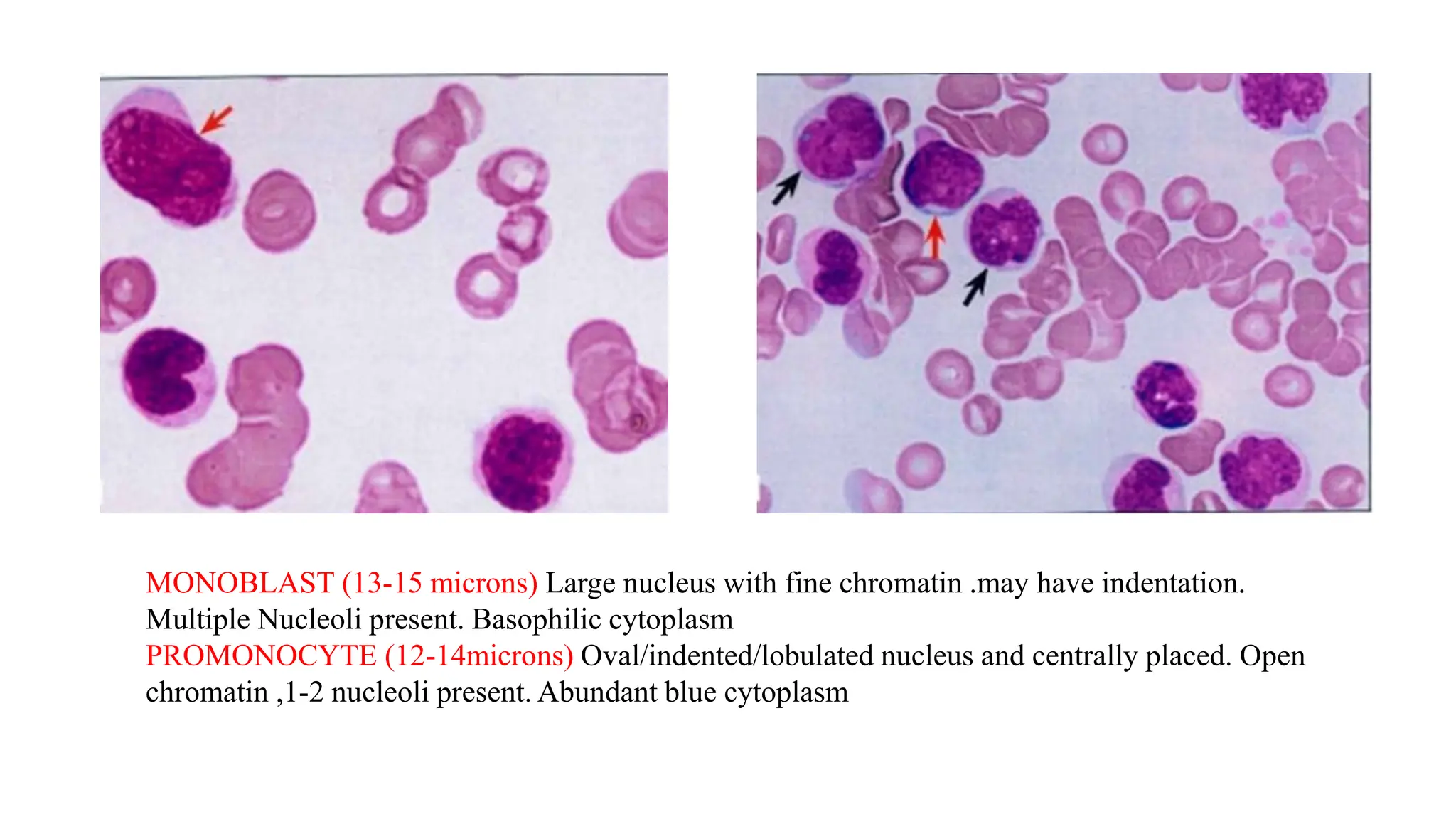 QUIZ ON BONE MARROW-MICROCYTIC + APLASTIC.pptx