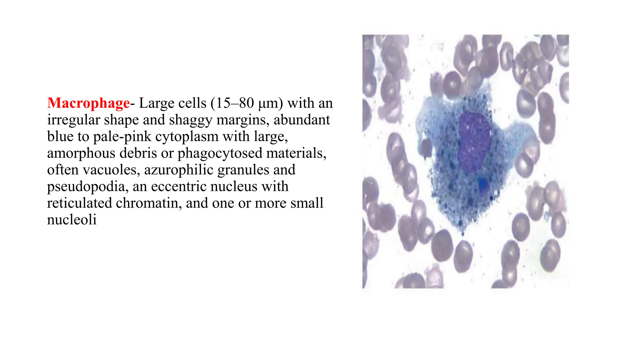 QUIZ ON BONE MARROW-MICROCYTIC + APLASTIC.pptx