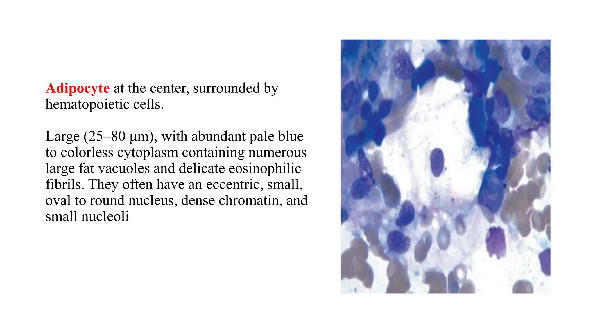 QUIZ ON BONE MARROW-MICROCYTIC + APLASTIC.pptx