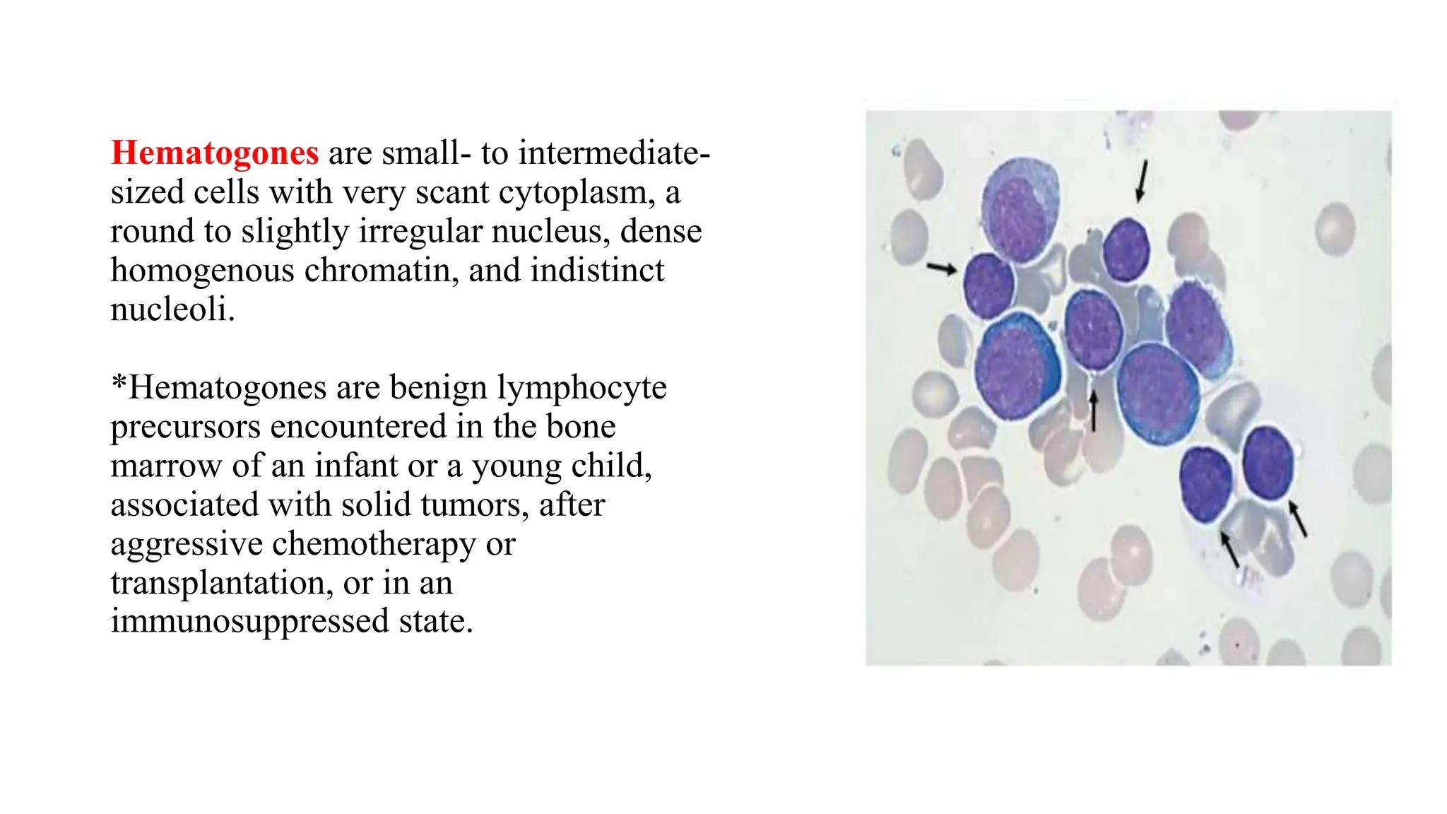 QUIZ ON BONE MARROW-MICROCYTIC + APLASTIC.pptx