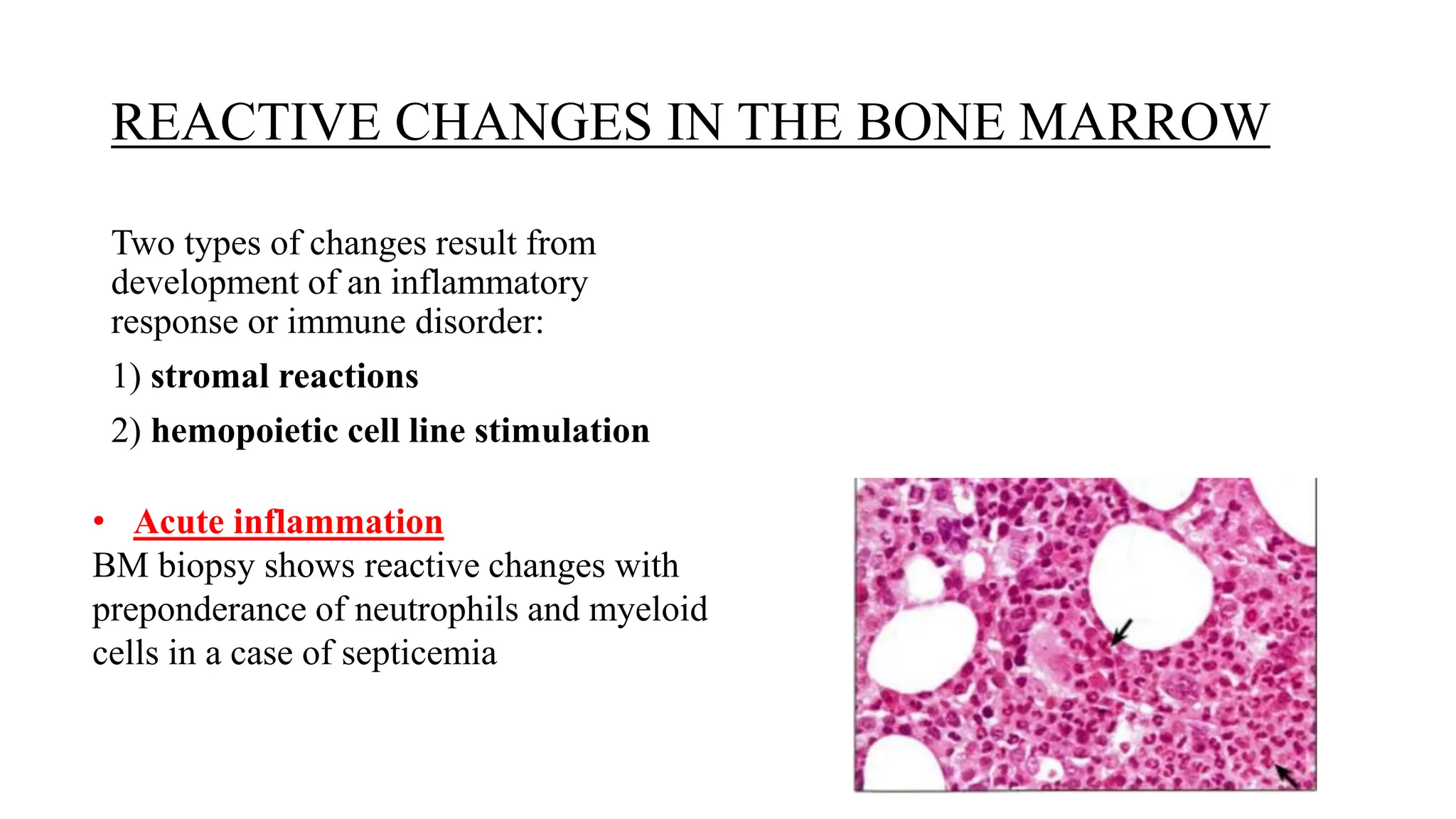 QUIZ ON BONE MARROW-MICROCYTIC + APLASTIC.pptx