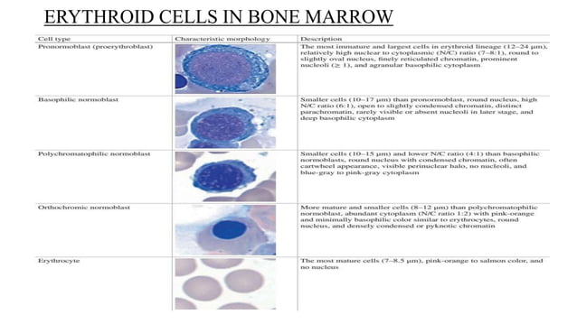 QUIZ ON BONE MARROW-MICROCYTIC + APLASTIC.pptx