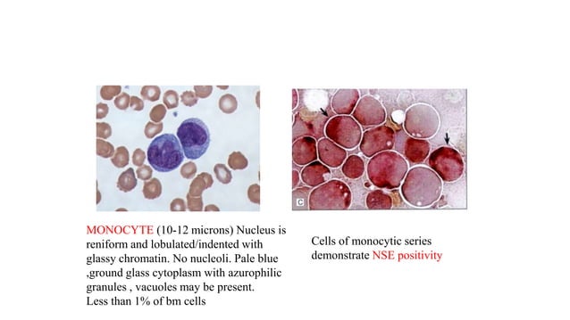 QUIZ ON BONE MARROW-MICROCYTIC + APLASTIC.pptx