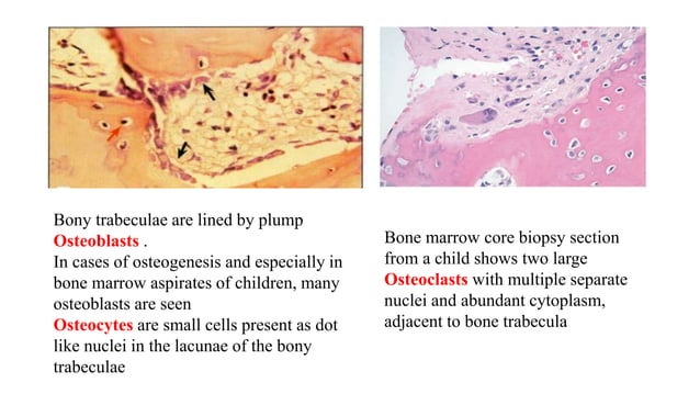 QUIZ ON BONE MARROW-MICROCYTIC + APLASTIC.pptx
