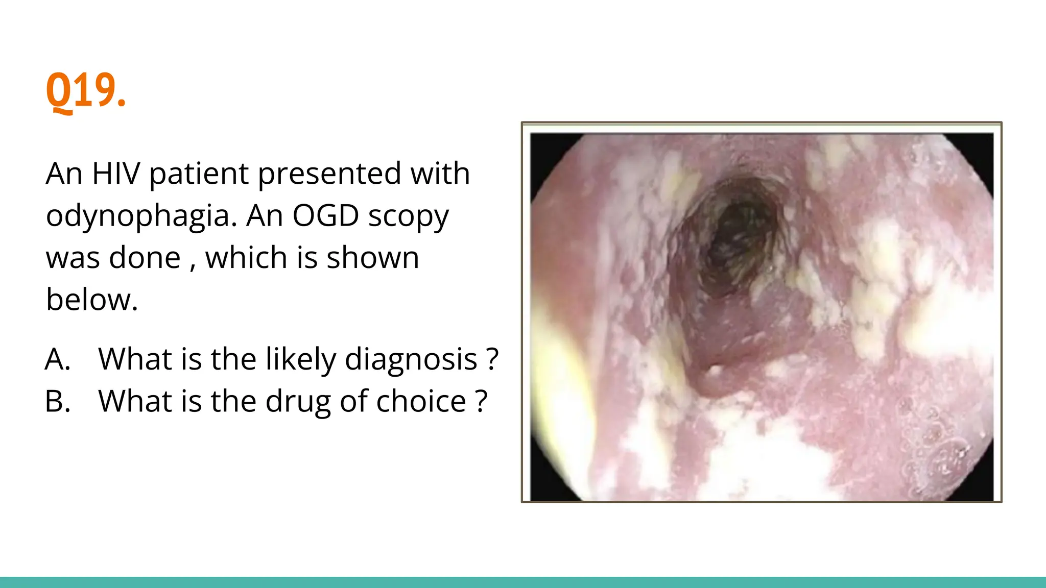 QUIZ ON HIV AIDS ( World AIDS DAY 2024 ).pdf