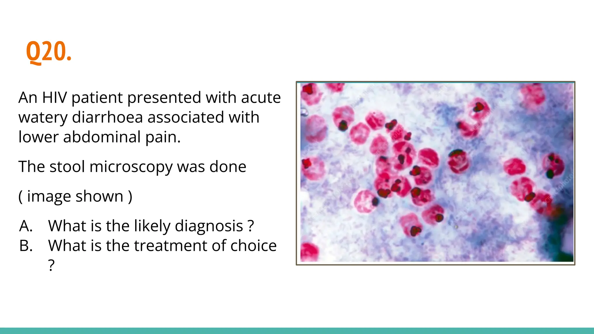 QUIZ ON HIV AIDS ( World AIDS DAY 2024 ).pdf
