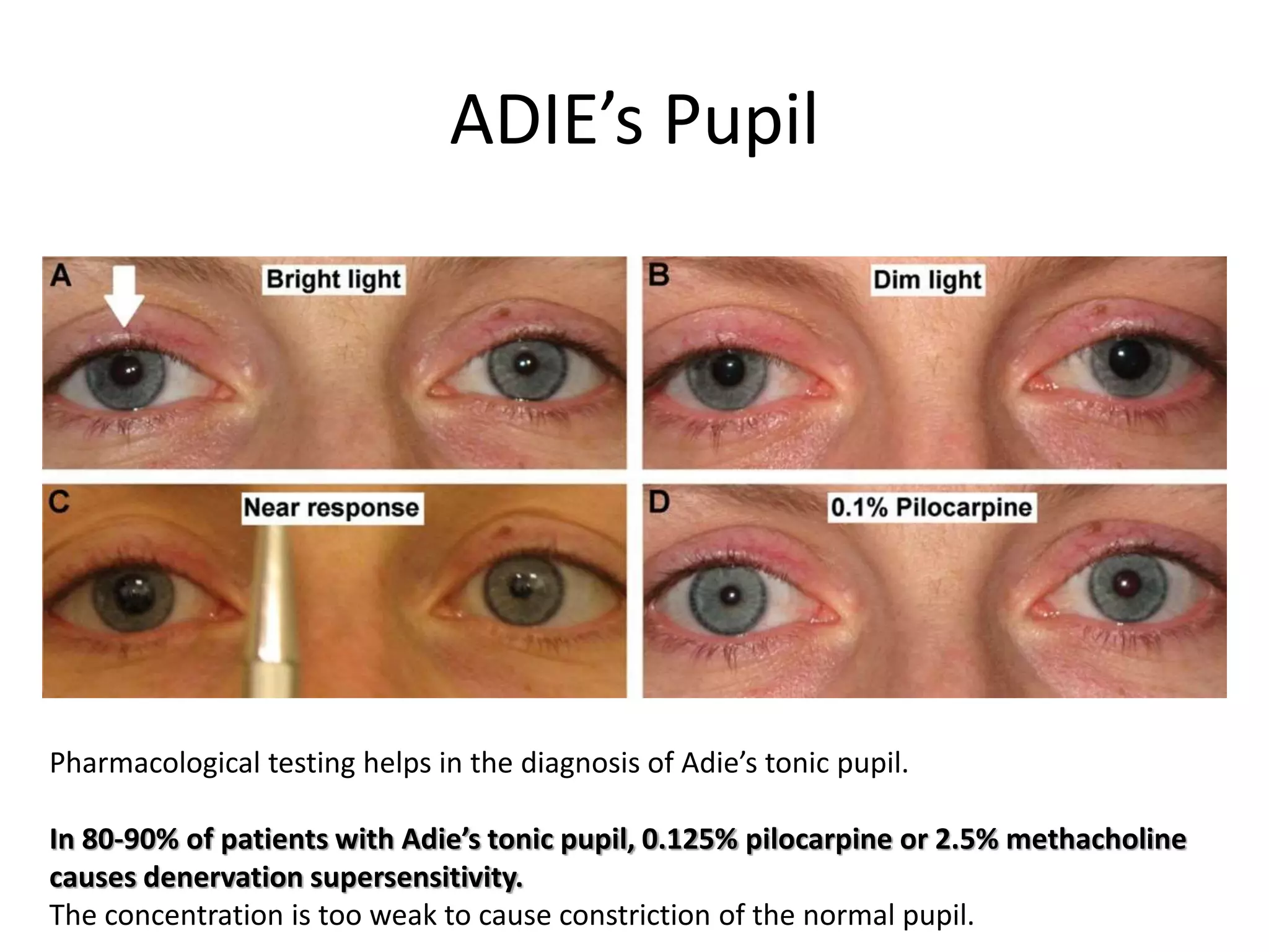 Examination of pupil by pushkar dhir | PPTX