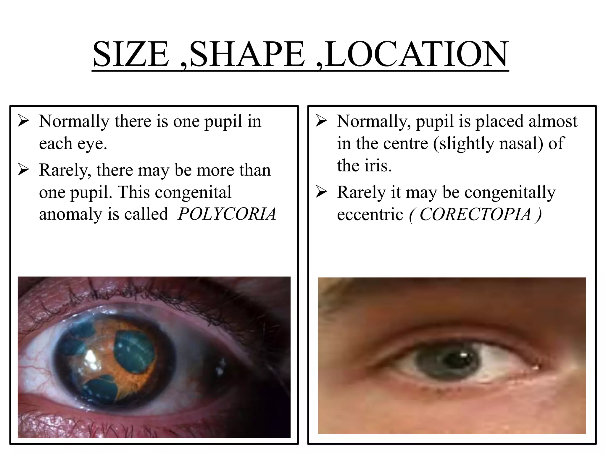 Examination of pupil by pushkar dhir | PPTX