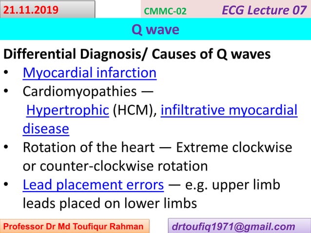 ECG-Q wave | PPT