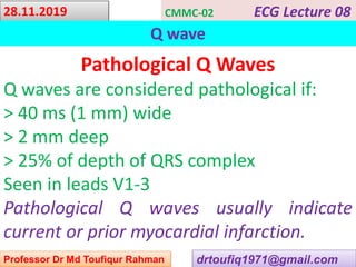 Abnormal Q Wave Mi