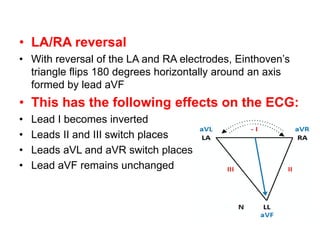 Q WAVE IN ECG,CAUSES OF PATHOLOGICAL Q WAVES | PPTX