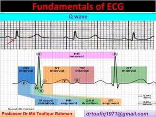 Approach to a patient with Q wave abnormality in ECG | PPSX