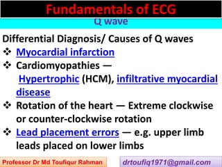 Approach to a patient with Q wave abnormality in ECG | PPSX