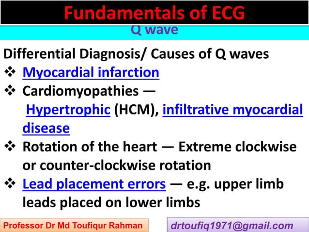 Approach to a patient with Q wave abnormality in ECG | PPT