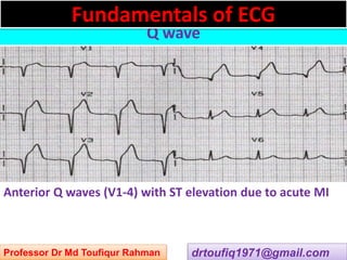 Approach to a patient with Q wave abnormality in ECG | PPSX